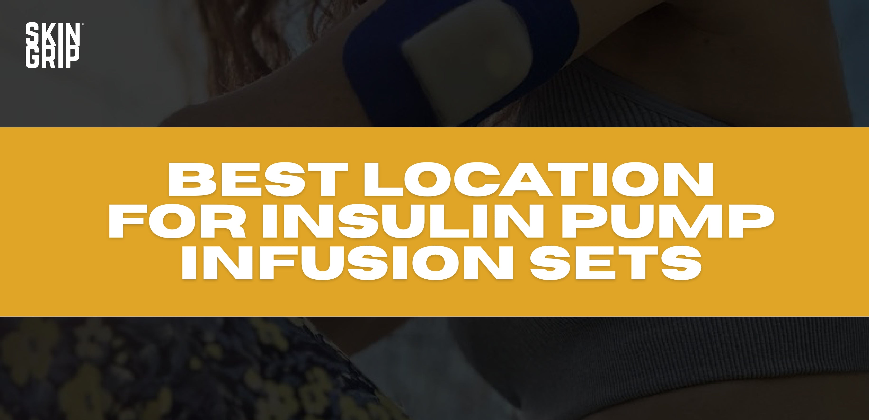 Best location for insulin pump infusion sets – Skin Grip