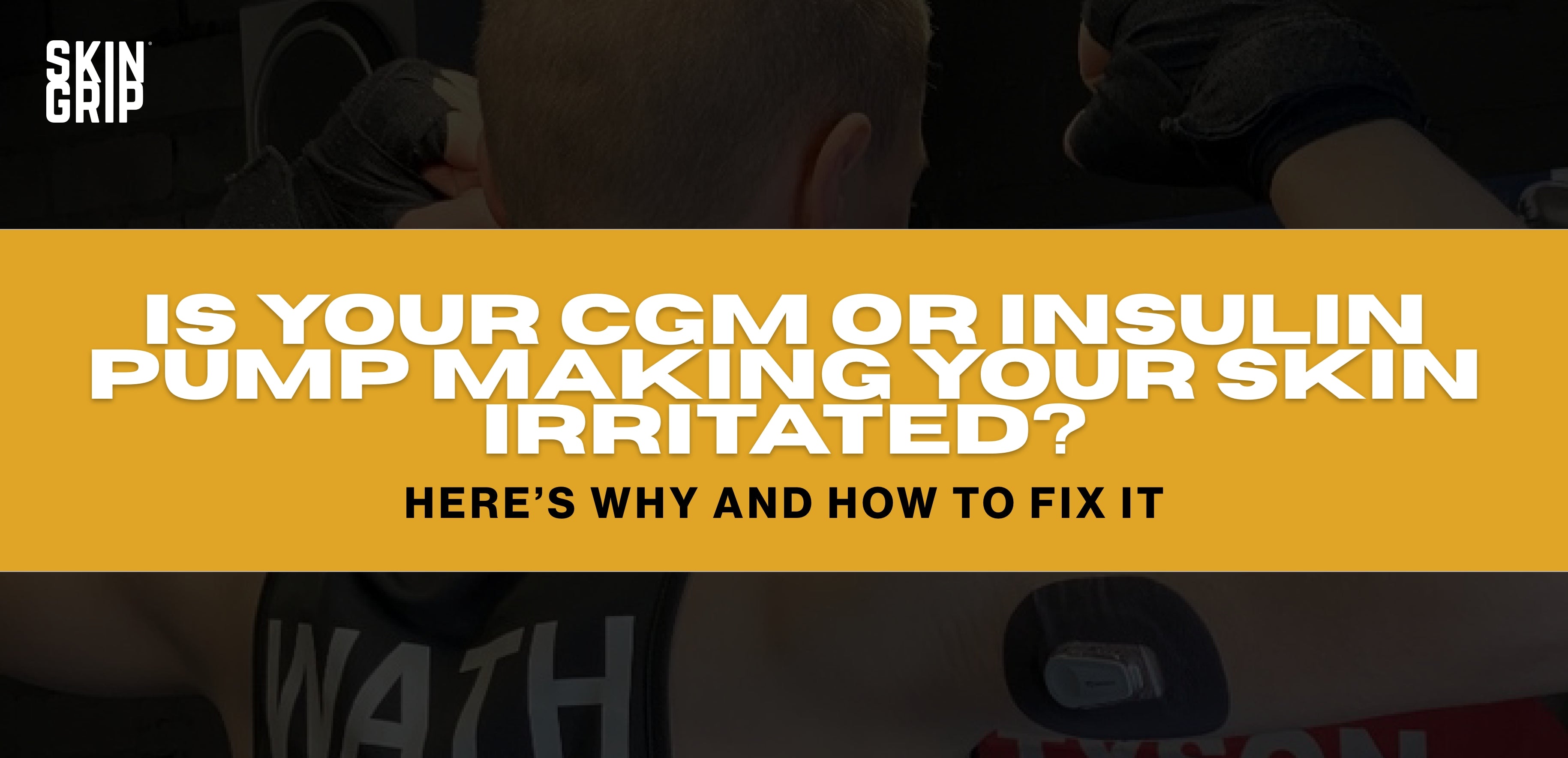Is Your CGM or Insulin Pump Making Your Skin Irritated? Here's Why and ...
