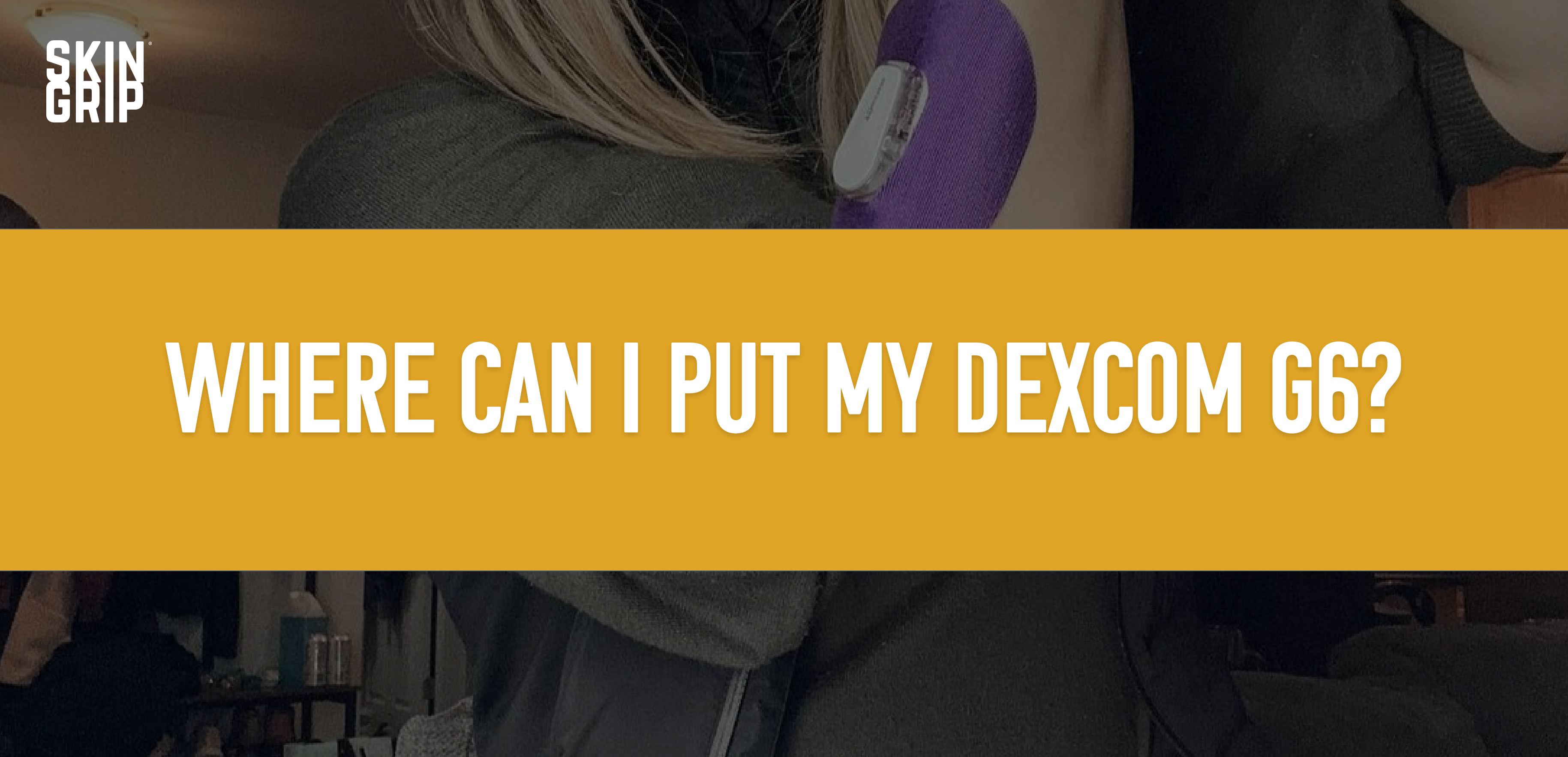 Dexcom G6 Placement: Best Spots on Your Body to Wear It – Skin Grip