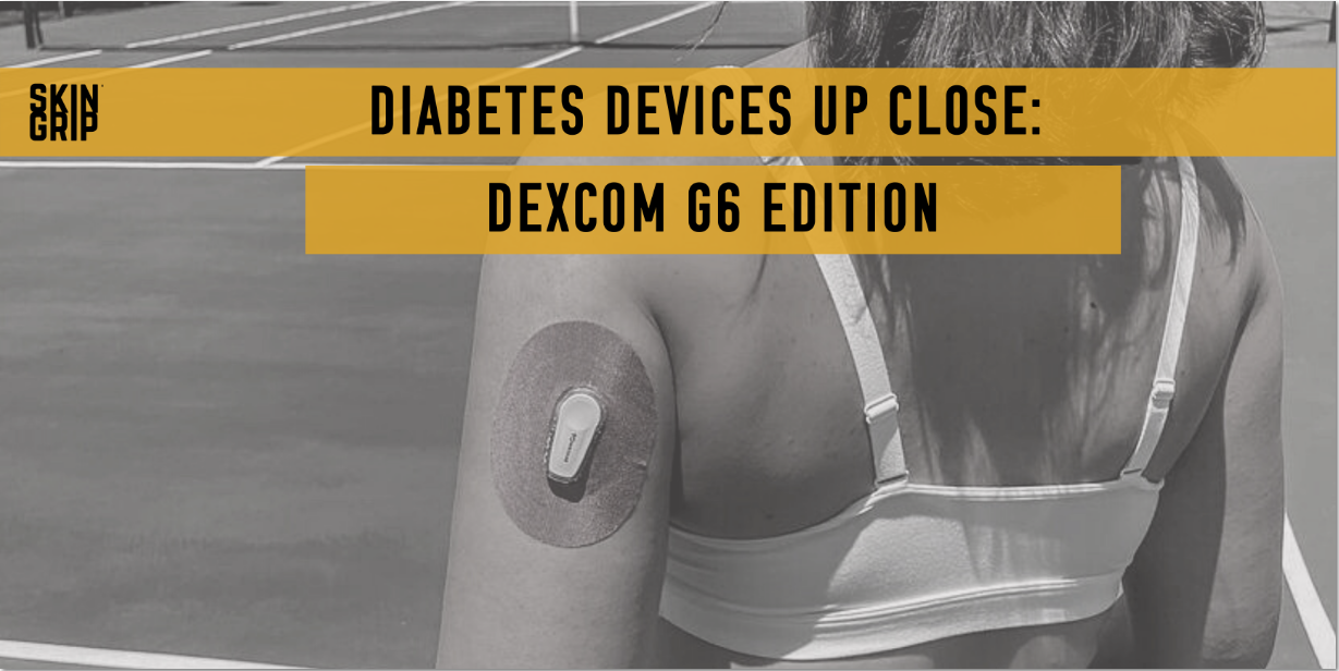 Diabetes Devices Up Close: Dexcom G6 Edition – Skin Grip