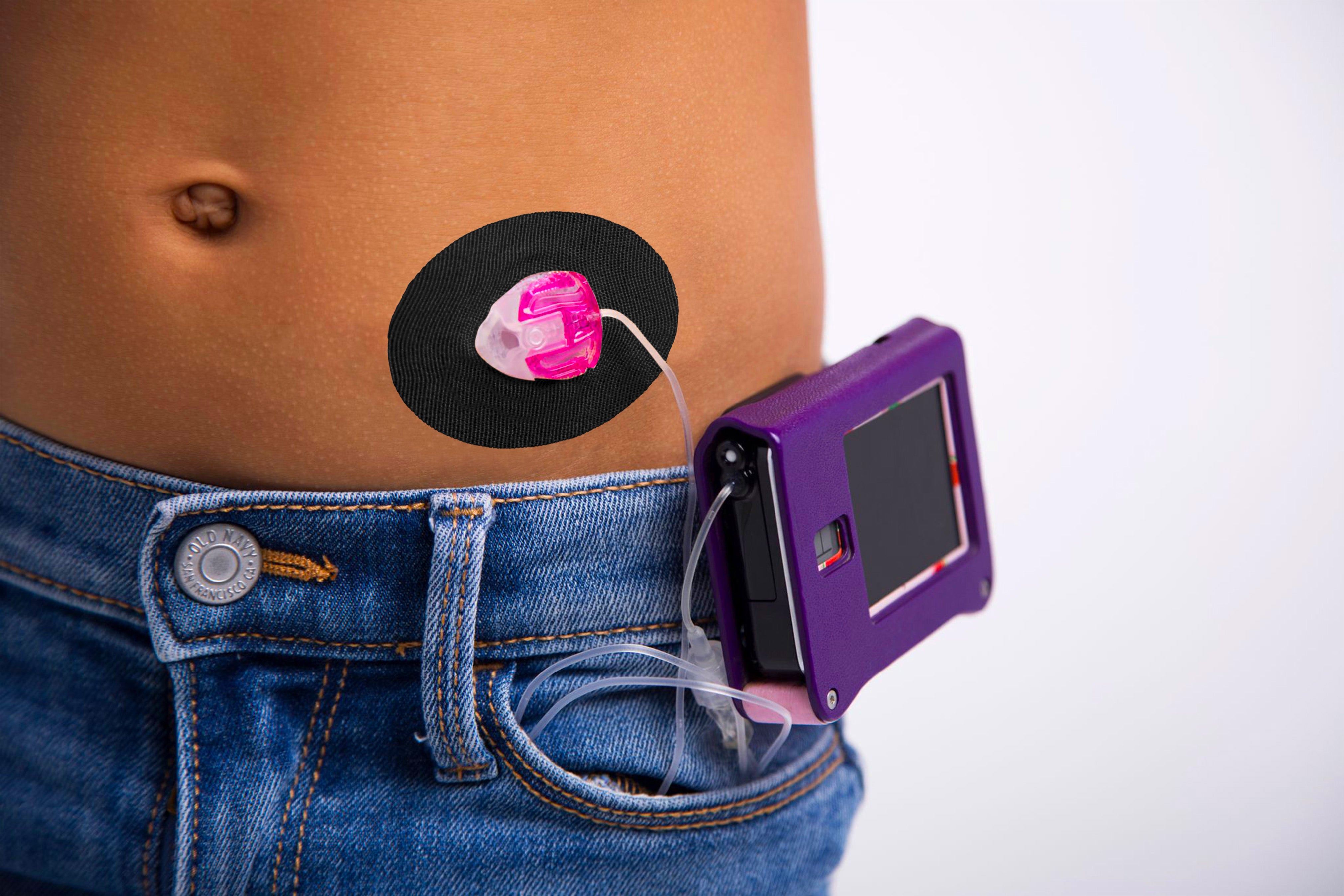 Skin Grip Original - Universal Adhesive Patches (0.8 inch Hole)